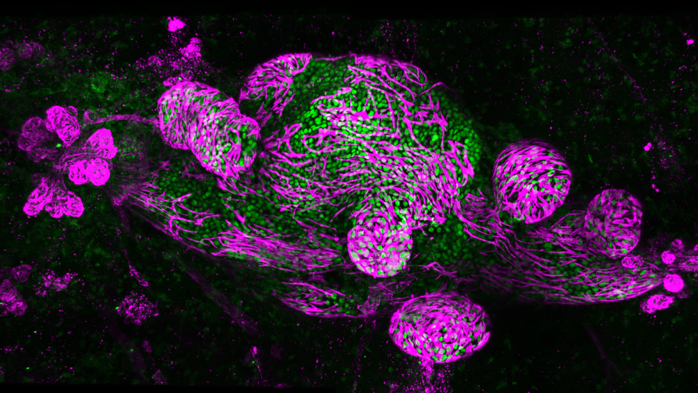 Impact | Cancer Grand Challenges